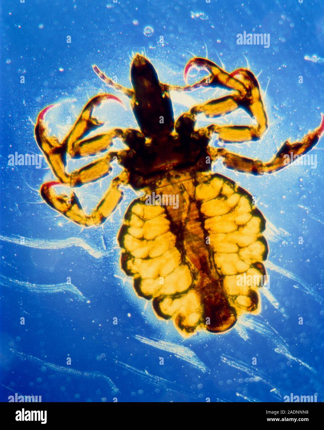 Body louse. Light micrograph of the blood- sucking human body louse ...