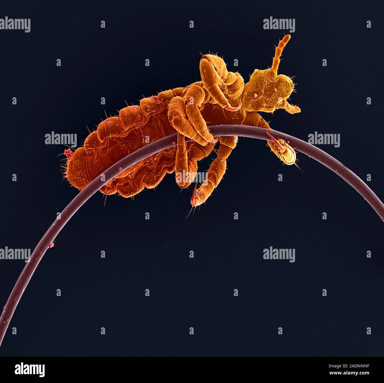 Head louse. Coloured scanning electron micrograph (SEM) of a head louse ...