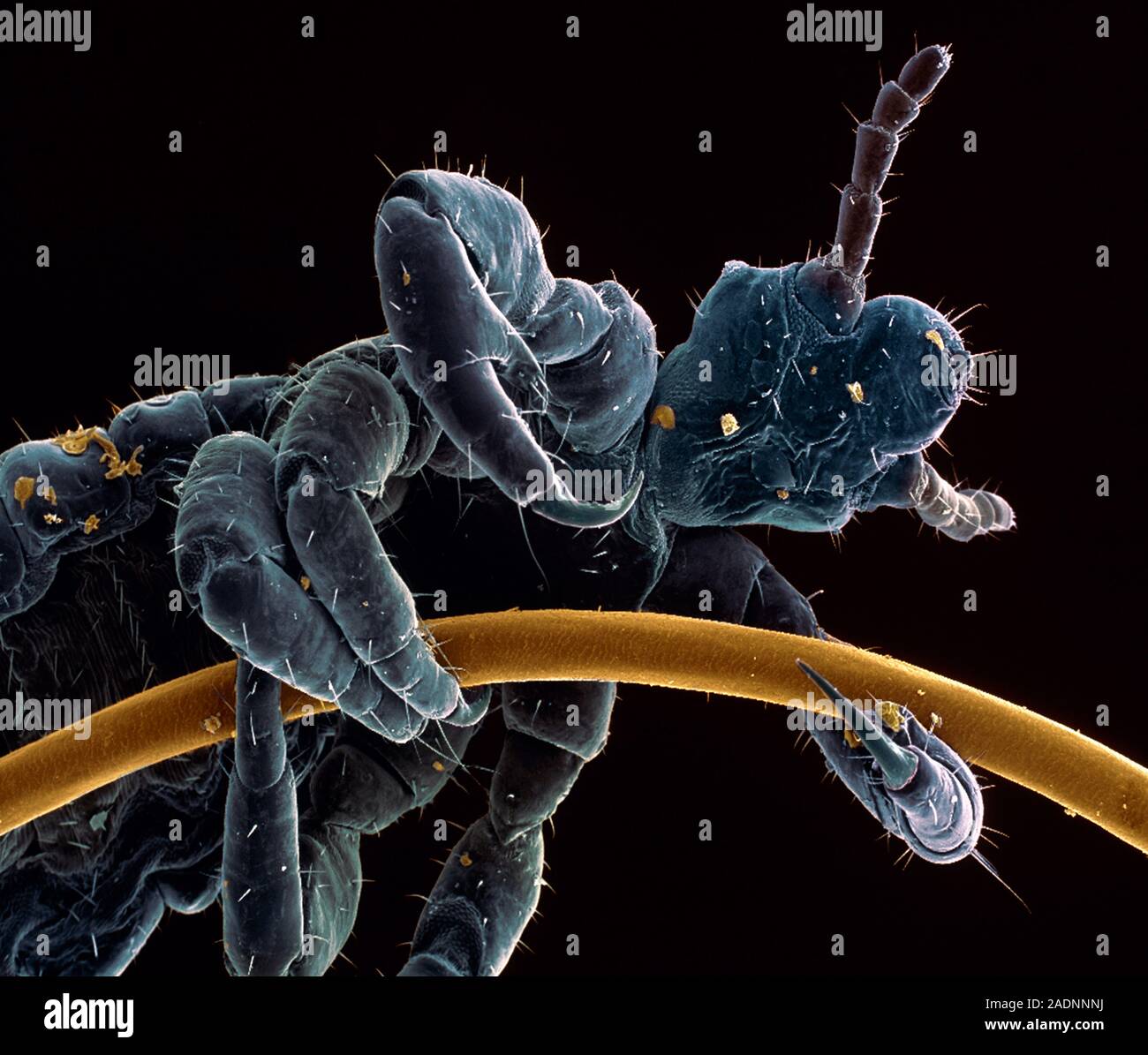 Head louse. Coloured scanning electron micrograph (SEM) of the head and ...