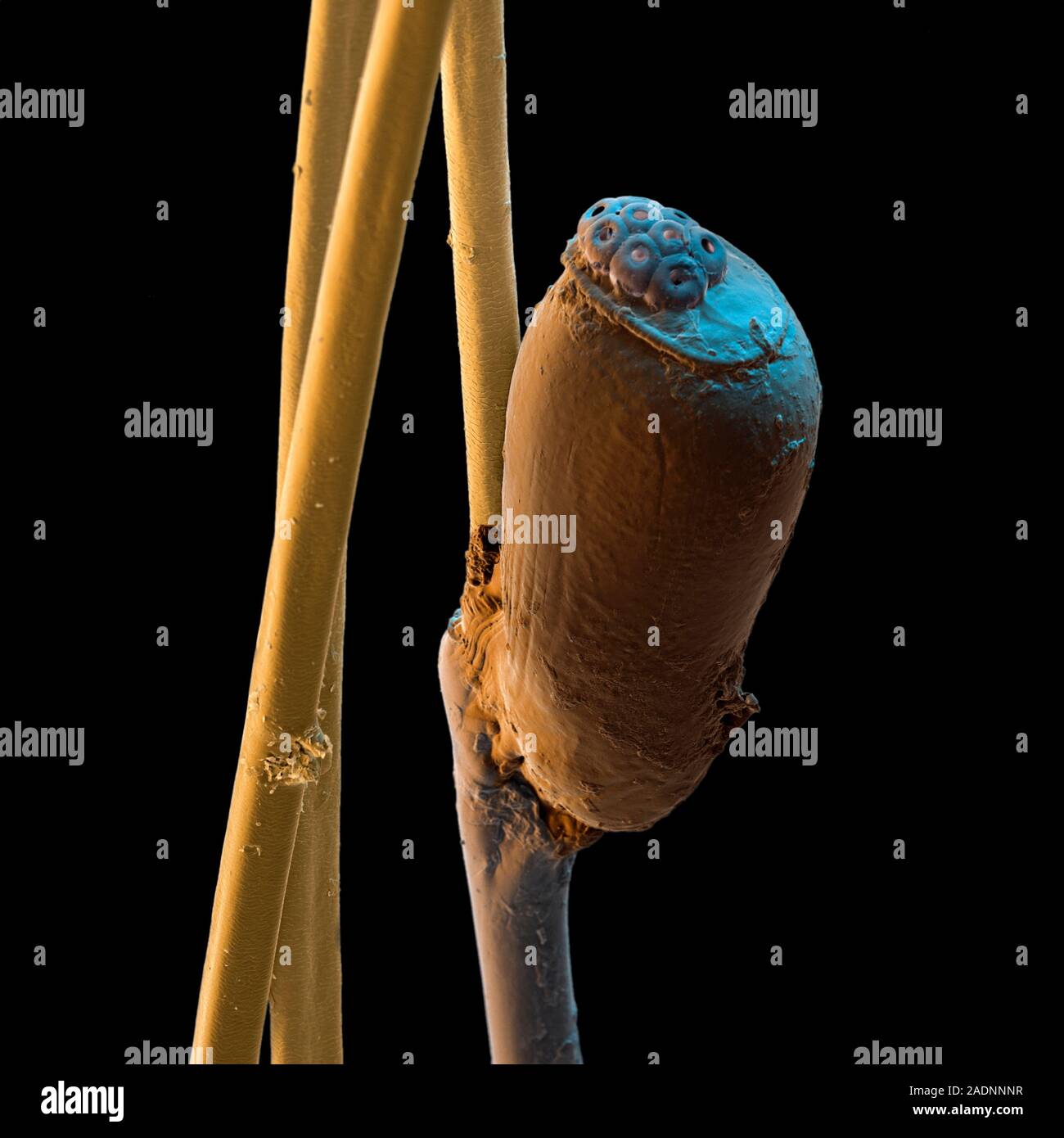 Head louse nit. Coloured scanning electron micrograph (SEM) of a nit ...