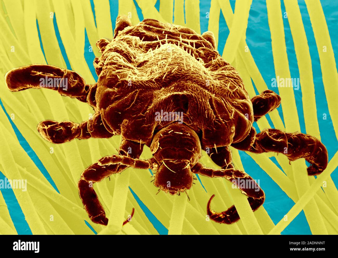 Pubic louse. Coloured scanning electron micrograph (SEM) of a pubic ...