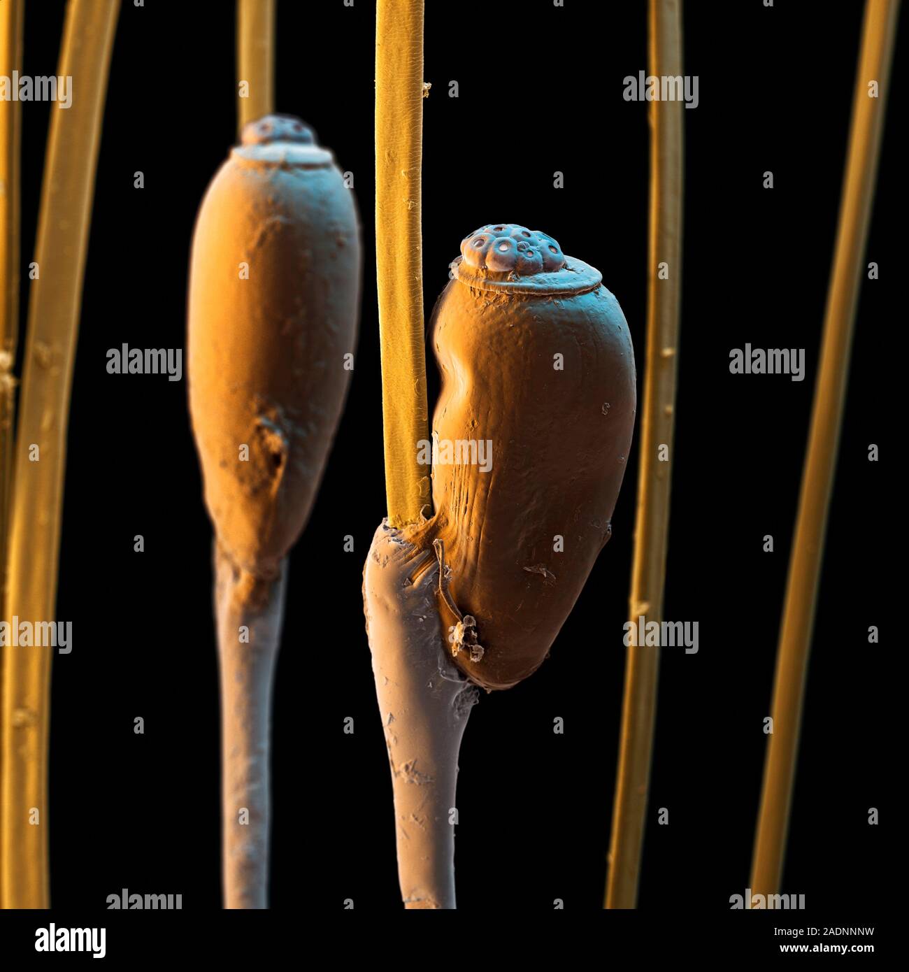 Head louse nits. Coloured scanning electron micrograph (SEM) of two ...