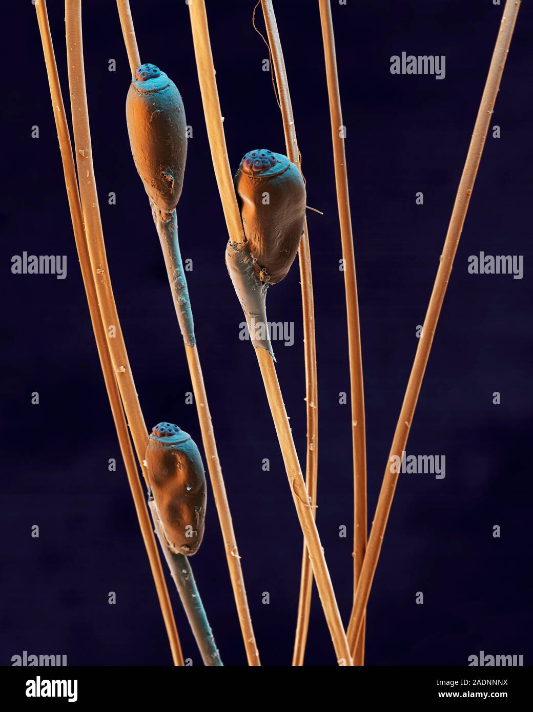 Head louse nits. Coloured scanning electron micrograph (SEM) of three ...