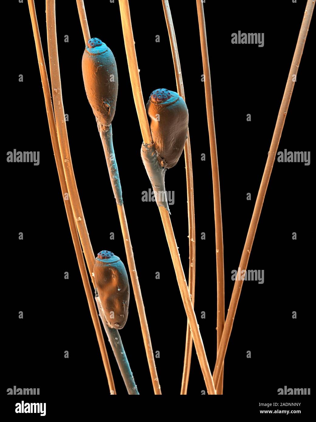 Head louse nits. Coloured scanning electron micrograph (SEM) of three ...
