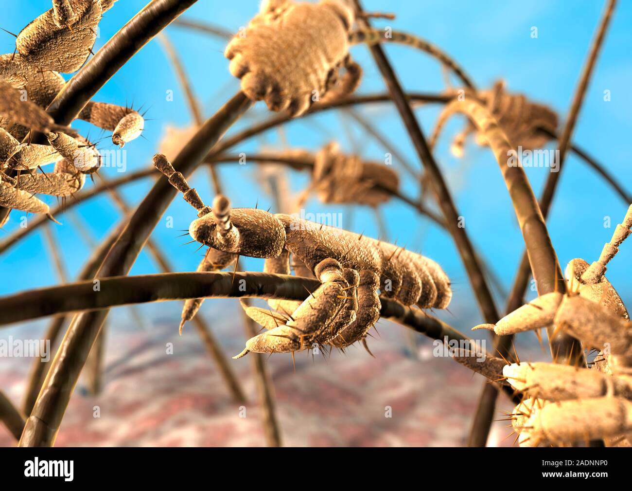 Head lice. Computer artwork of head lice (Pediculus humanus capitis ...
