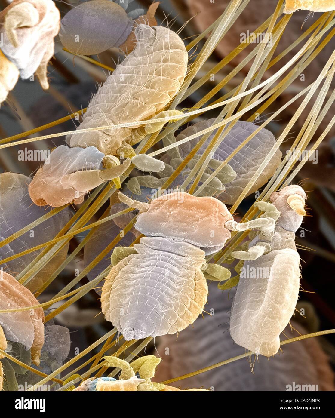 Badger body lice. Coloured scanning electron micrograph (SEM) of badger ... Badger body lice. Coloured scanning electron micrograph (SEM) of badger ...