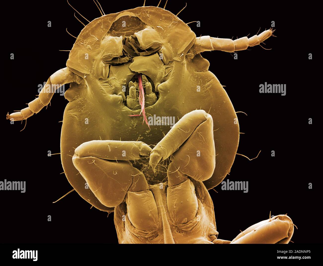 Feather louse head. Coloured scanning electron micrograph (SEM) of the ...