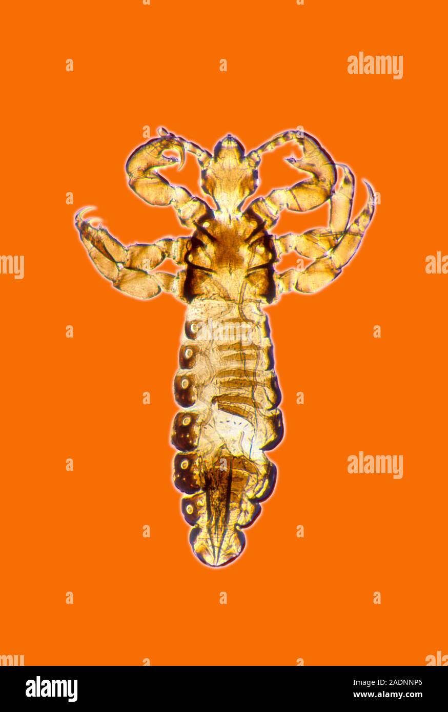 Human body louse (Pediculus humanus corporis), light micrograph. This ...