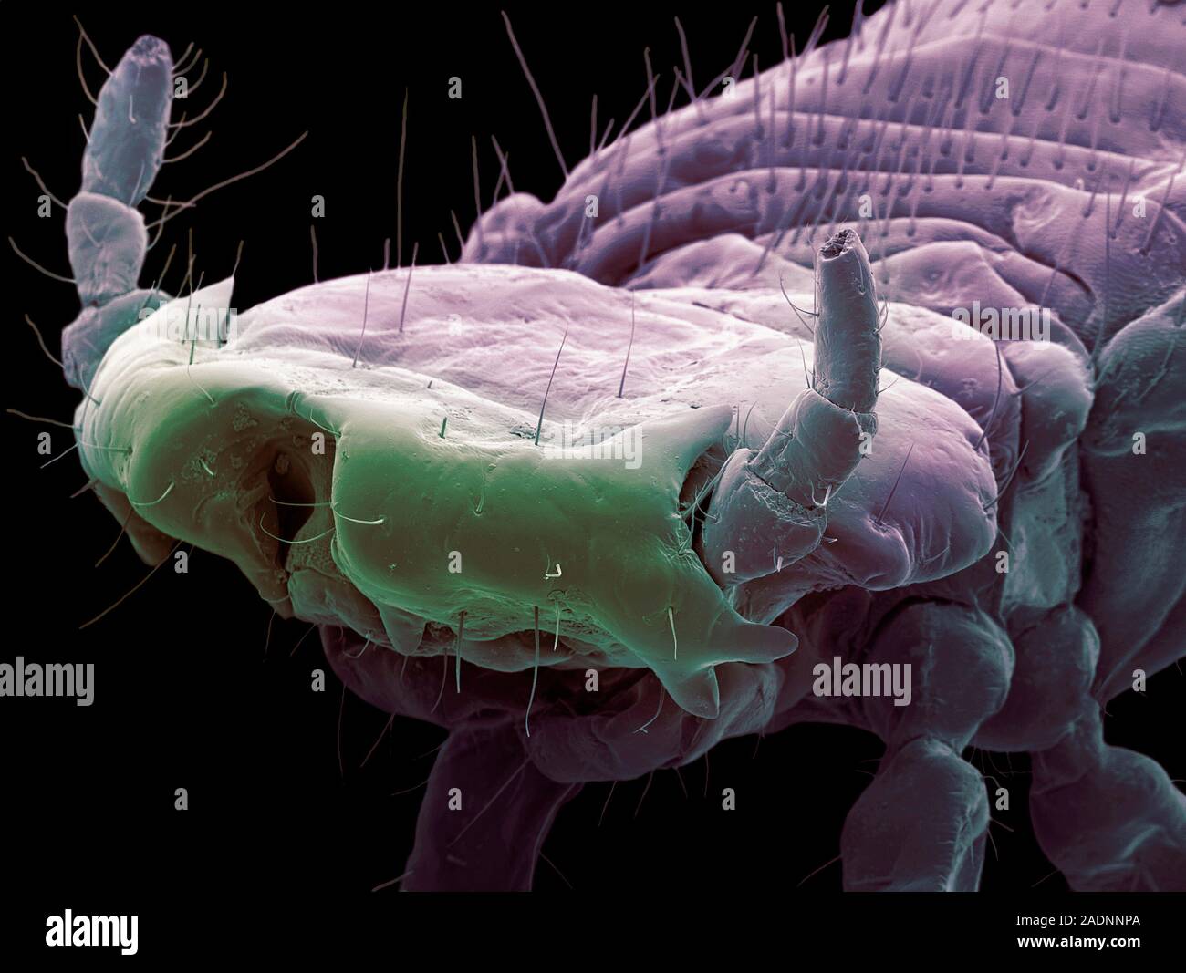 Badger body louse. Coloured scanning electron micrograph (SEM) of the ...