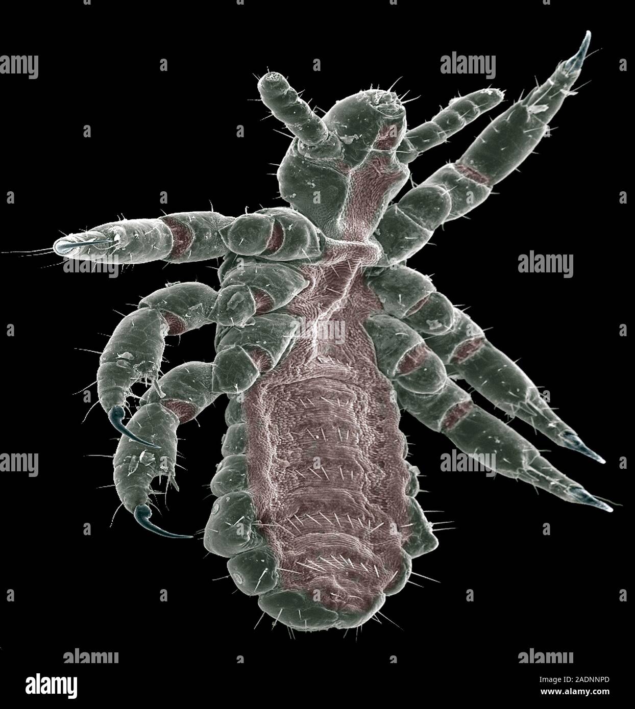 Head louse. Coloured scanning electron micrograph (SEM) of the ...