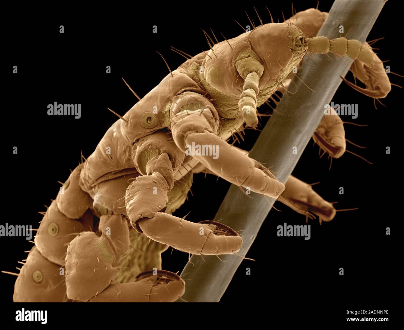 Head louse. Coloured scanning electron micrograph (SEM) of a head louse ...