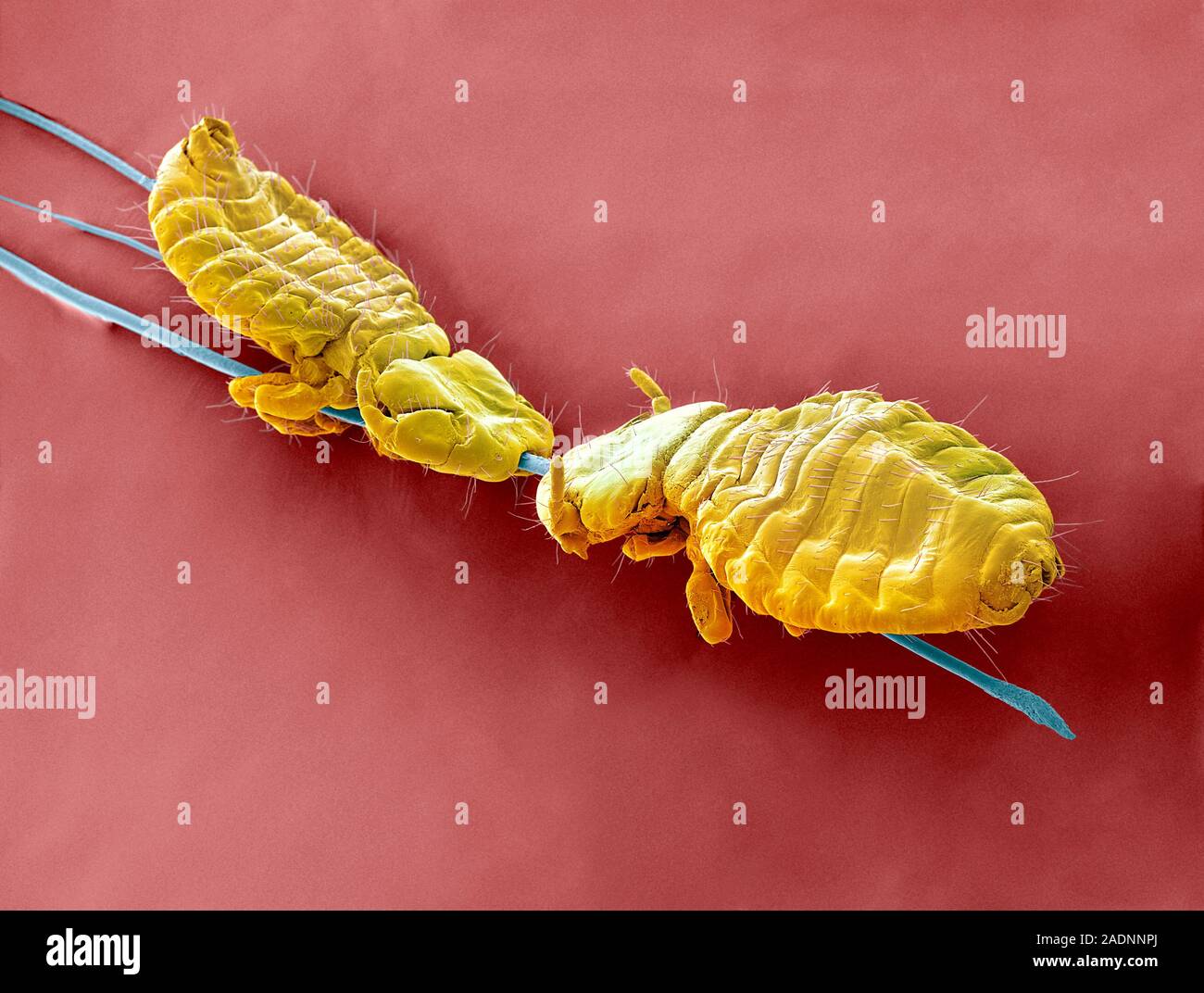 Badger body lice. Coloured scanning electron micrograph (SEM) of two ... Badger body lice. Coloured scanning electron micrograph (SEM) of two ...
