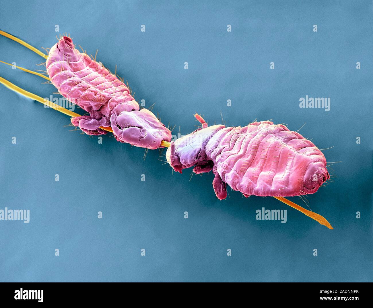 Badger body lice. Coloured scanning electron micrograph (SEM) of two ...