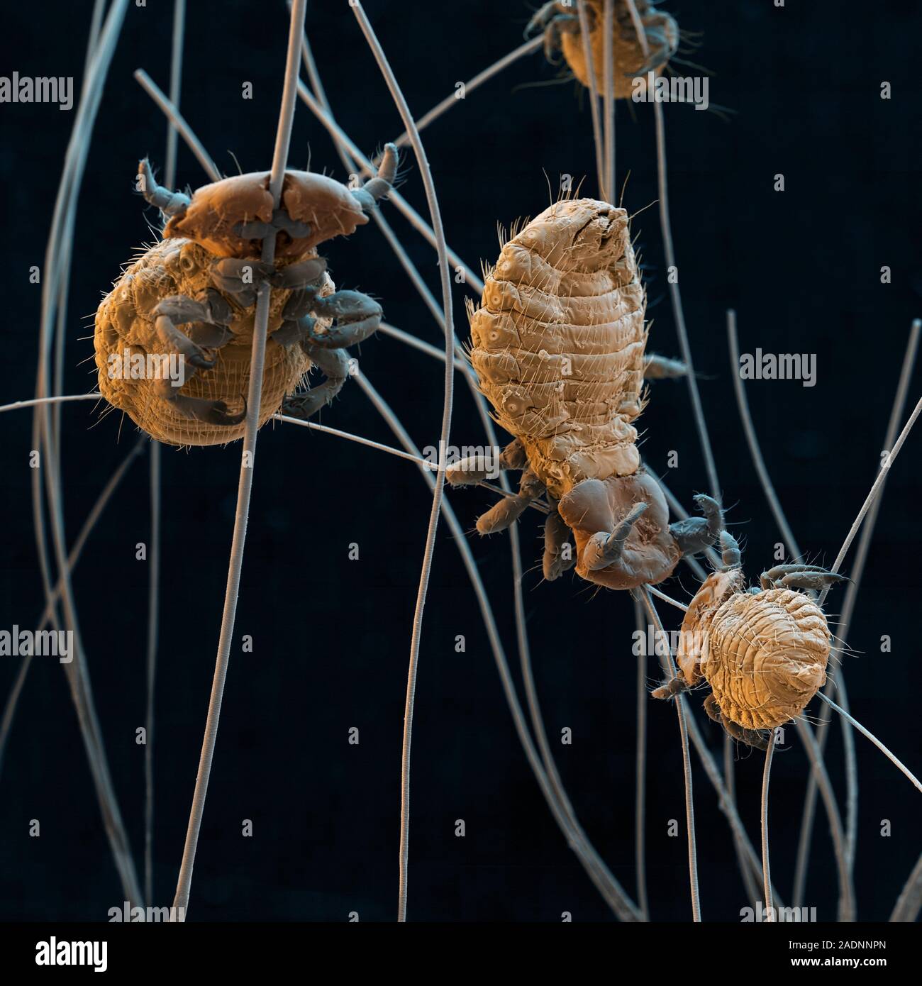 Dog biting lice. Coloured scanning electron micrograph (SEM) of dog ... Dog biting lice. Coloured scanning electron micrograph (SEM) of dog ...