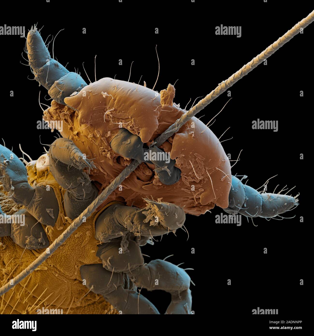 Dog biting louse. Coloured scanning electron micrograph (SEM) of a dog ...