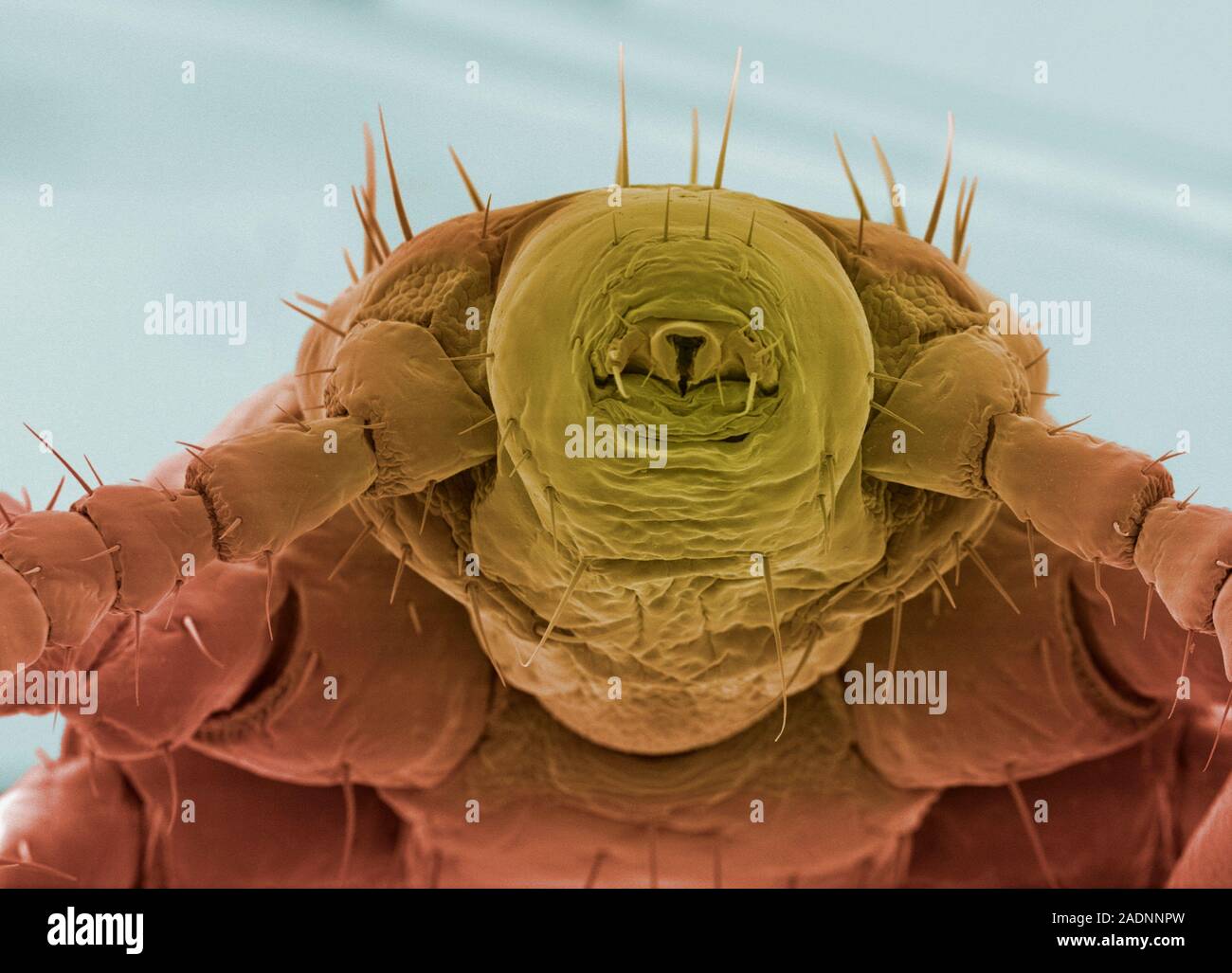 Head louse. Coloured scanning electron micrograph (SEM) of the head of ...