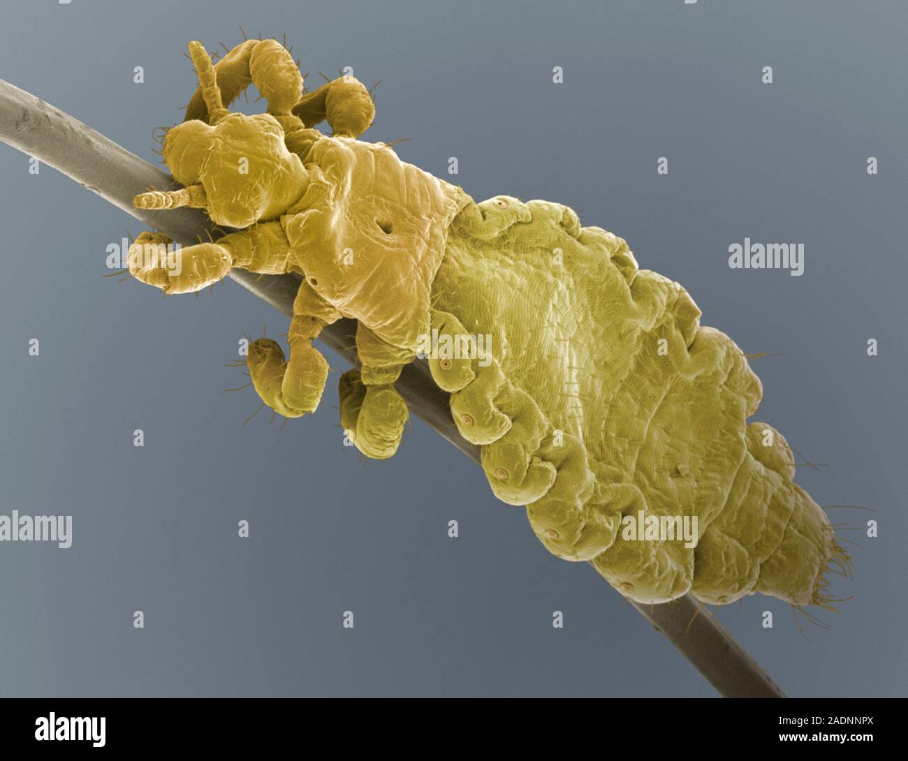 Head louse. Coloured scanning electron micrograph (SEM) of a head louse ...