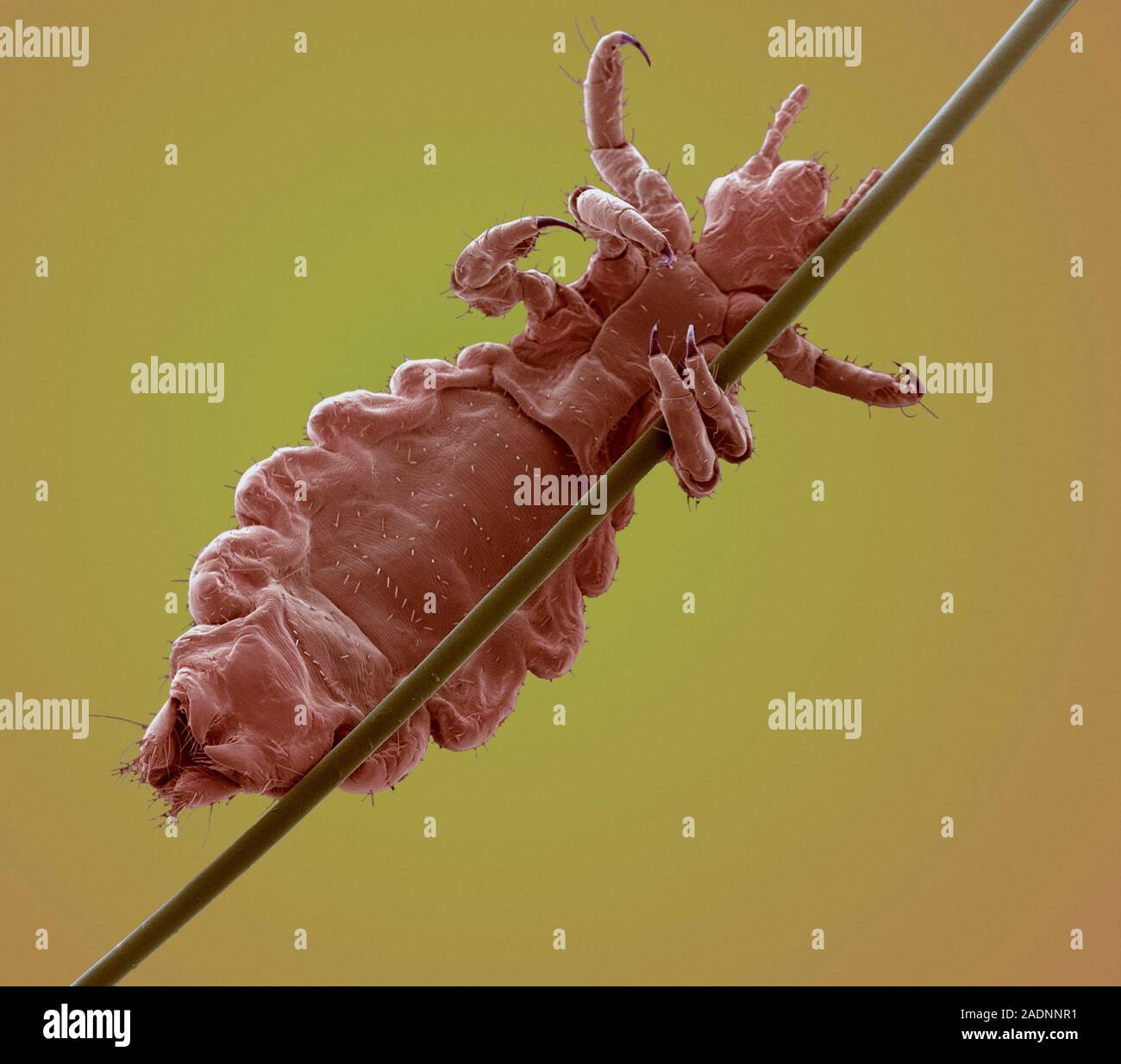 Head louse. Coloured scanning electron micrograph (SEM) of a head louse ...
