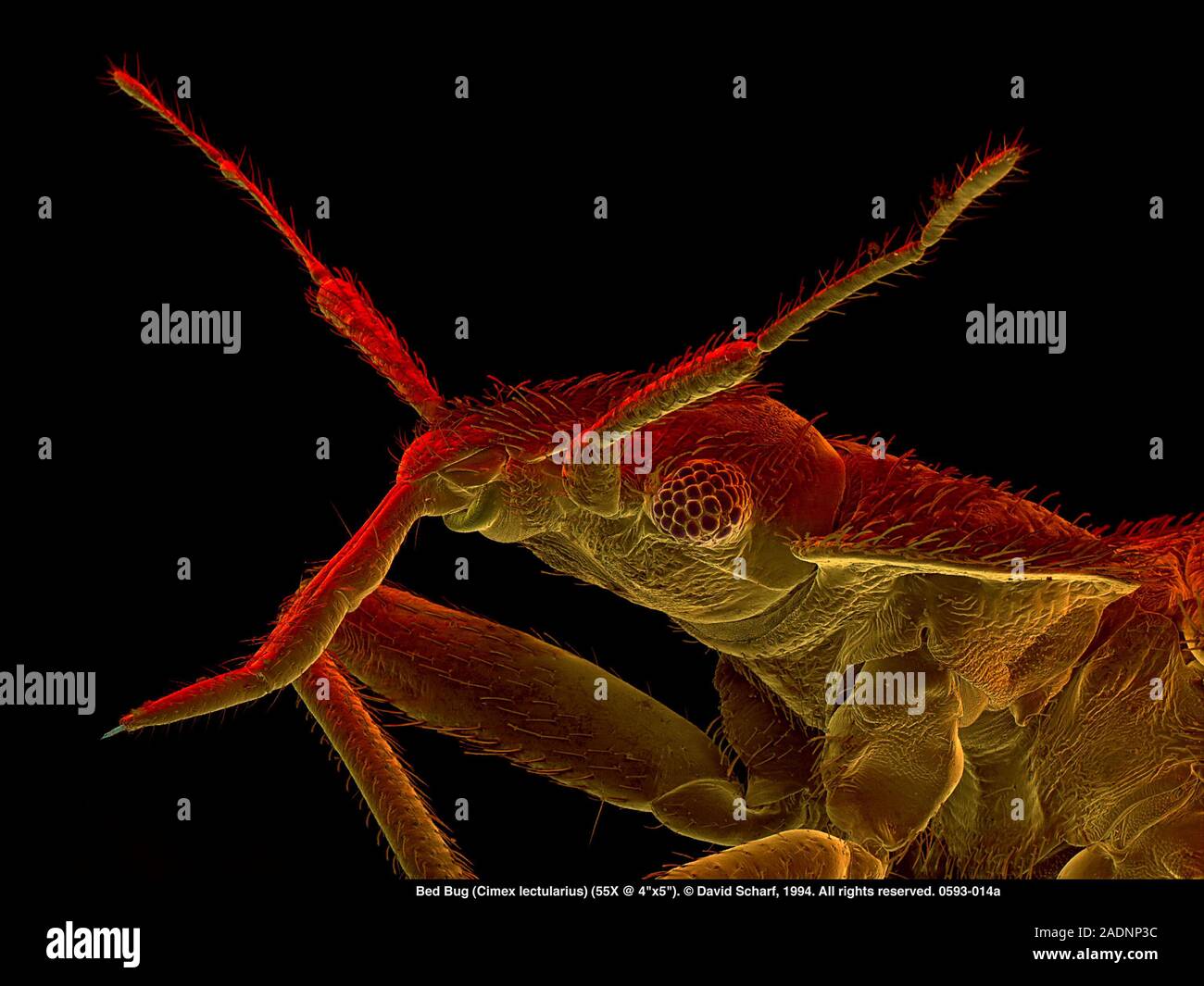 Bed bug. Coloured Scanning Electron Micrograph (SEM) of the head of a ...