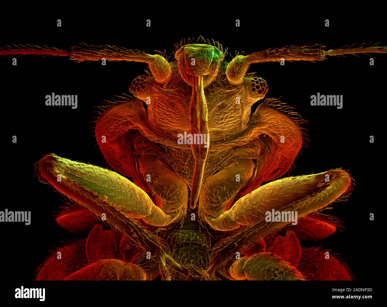 Bed bug. Coloured Scanning Electron Micrograph (SEM) of a bed bug ...