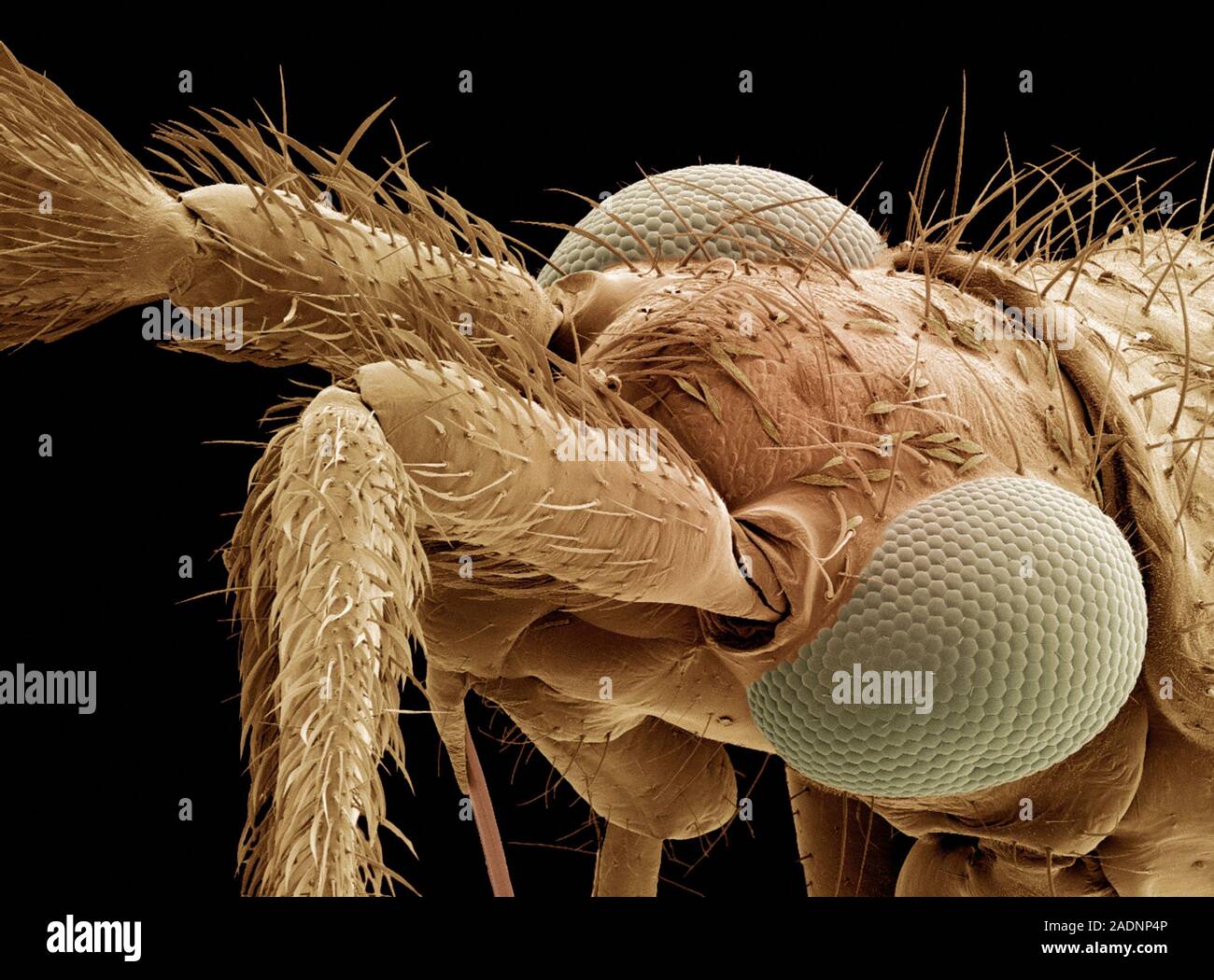 Insect's head. Coloured scanning electron micrograph (SEM) of the head ...