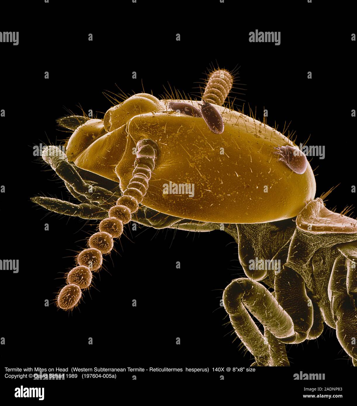 False-colour scanning electron micrograph of the head of a soldier ...