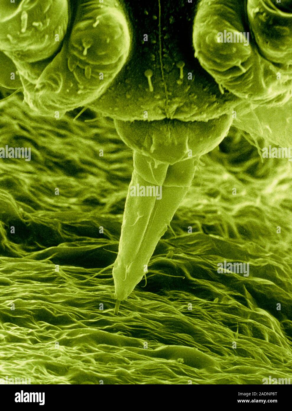 False-colour scanning electron micrograph (SEM) of the green peach ...