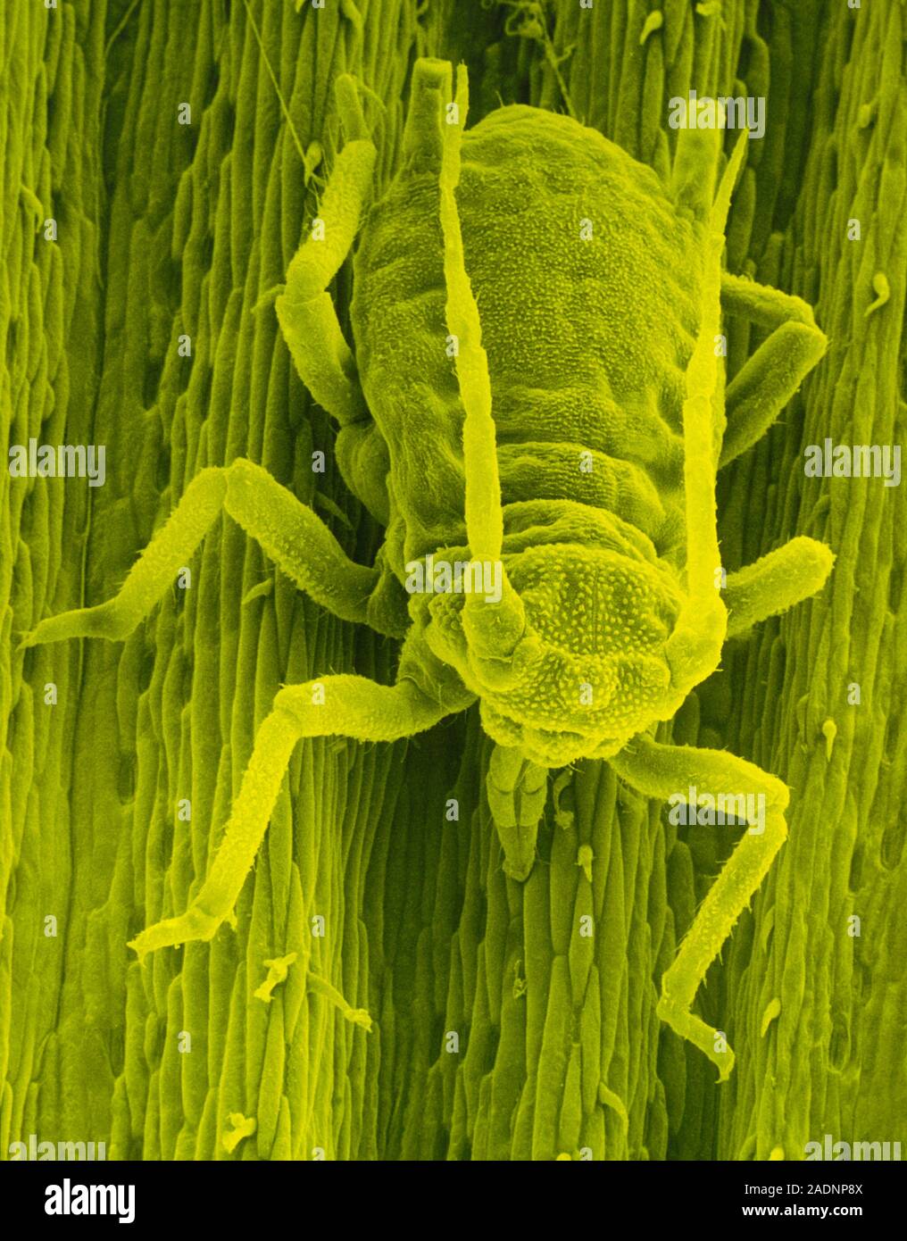 Scanning electron micrograph (SEM), tinted green, of a bird cherry ...