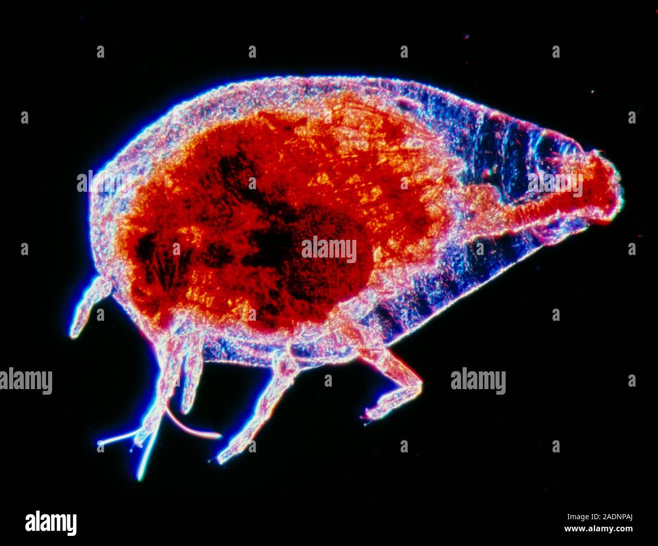Grape phylloxerid bug. Light micrograph of the grape phylloxerid insect ...