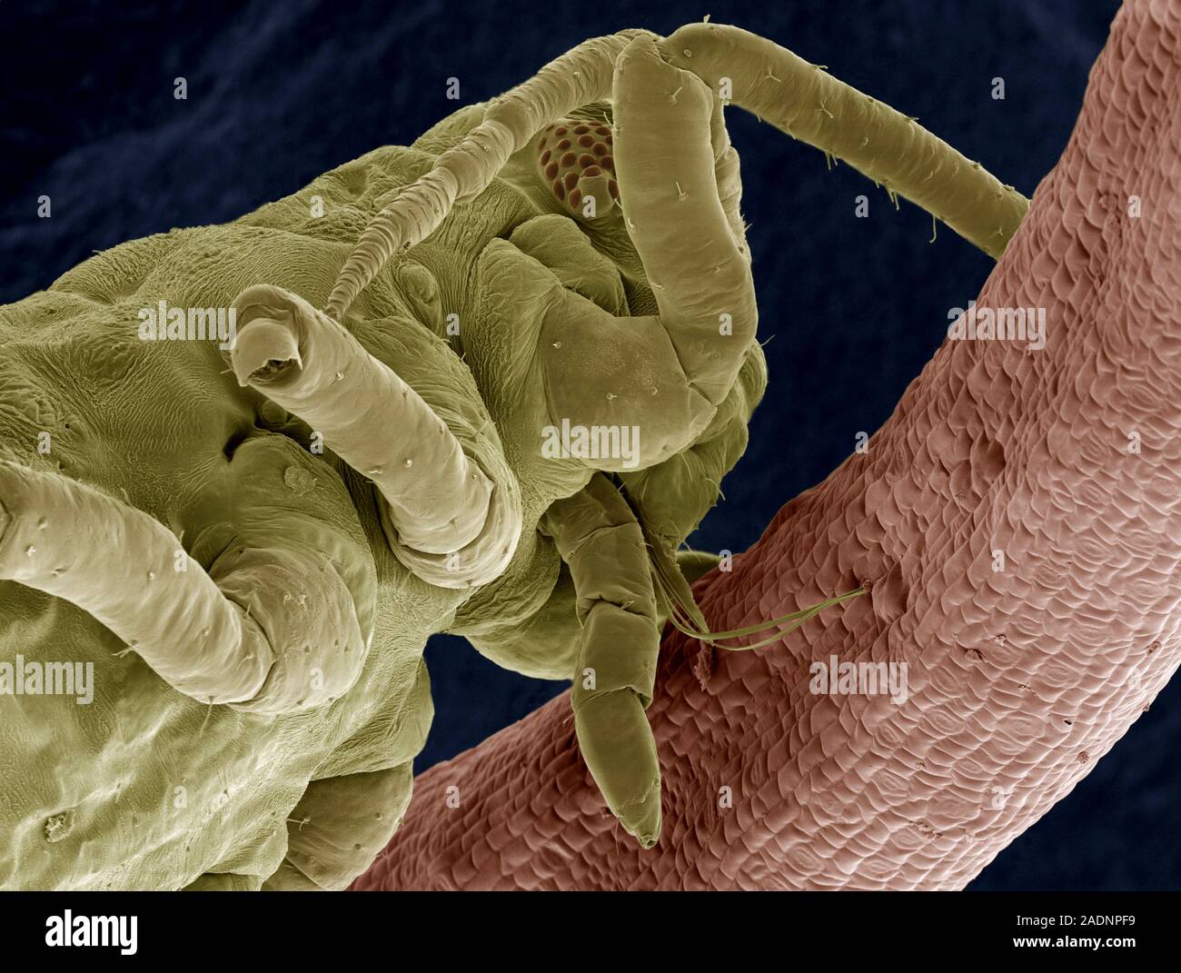 Aphid. Coloured scanning electron micrograph (SEM) of an aphid (family ...