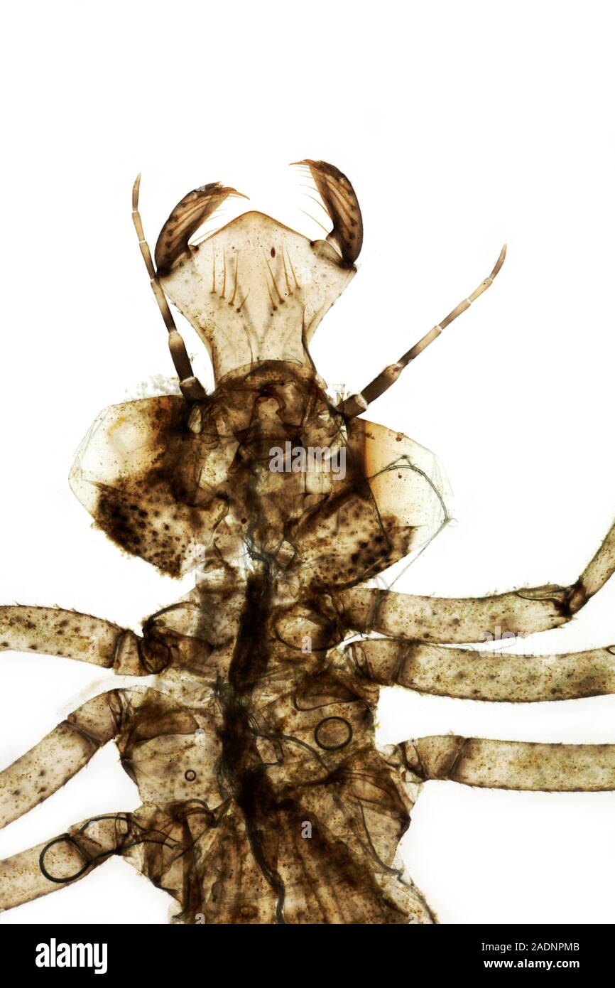 Damselfly Nymph Skin Light Micrograph Of The Head And Thorax Of A Shed