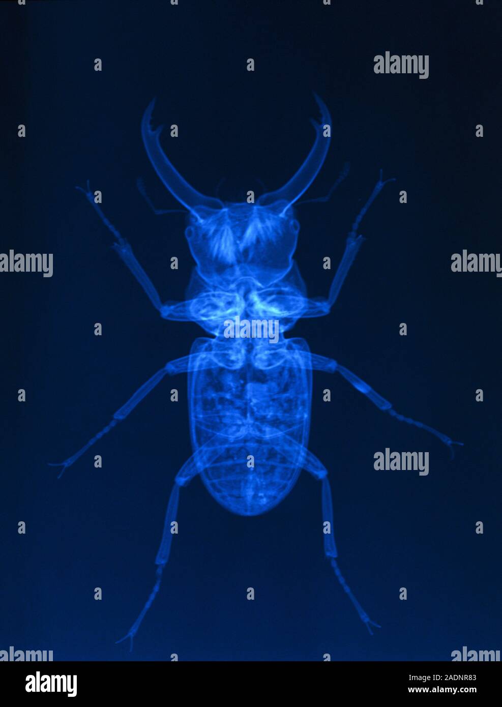 Stag beetle. X-ray of a male stag beetle Lucanus cervus (family ...