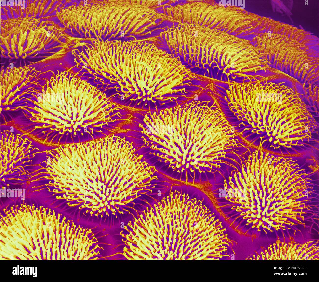 Beetle exoskeleton. Coloured scanning electron micrograph (SEM) of the ...