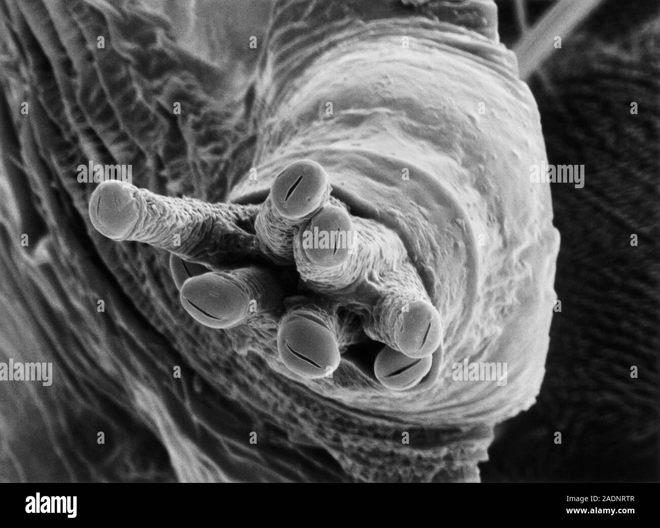 Scanning electron micrograph of a spiracle, or breathing tube, on the ...