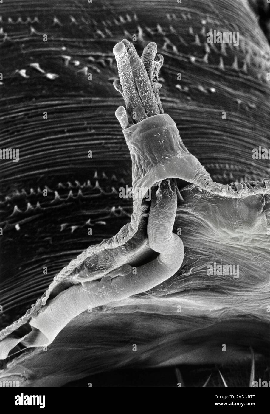 Scanning electron micrograph of an anterior spiracle, or breathing tube ...