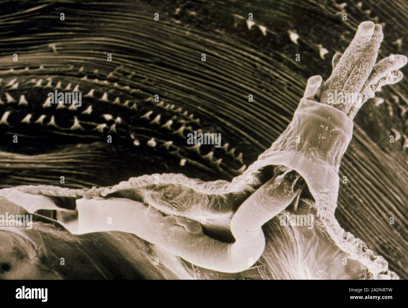 Scanning electron micrograph of an anterior spiracle, or breathing tube ...