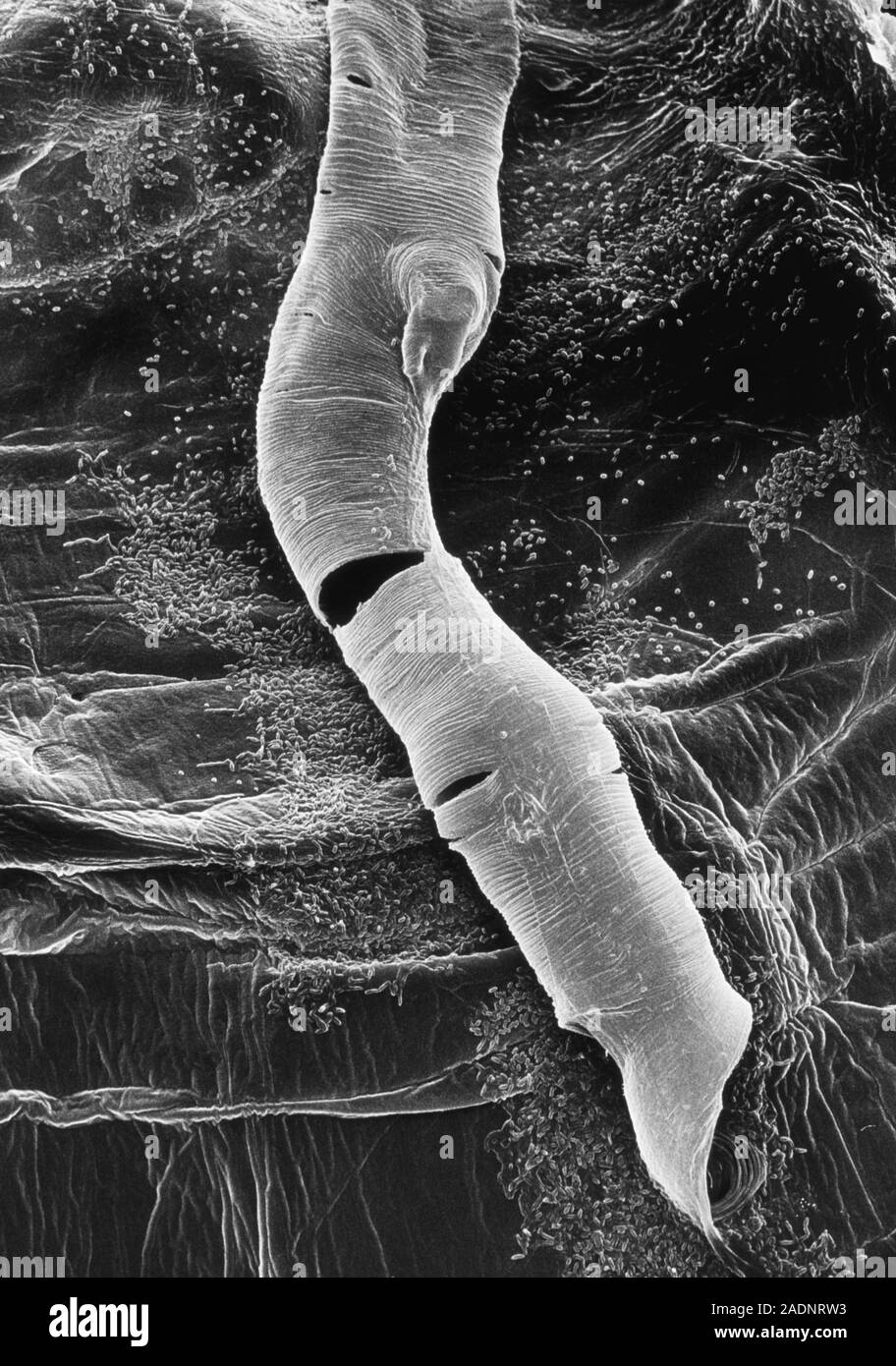 Scanning electron micrograph of the inner surface of a pupal case, or ...