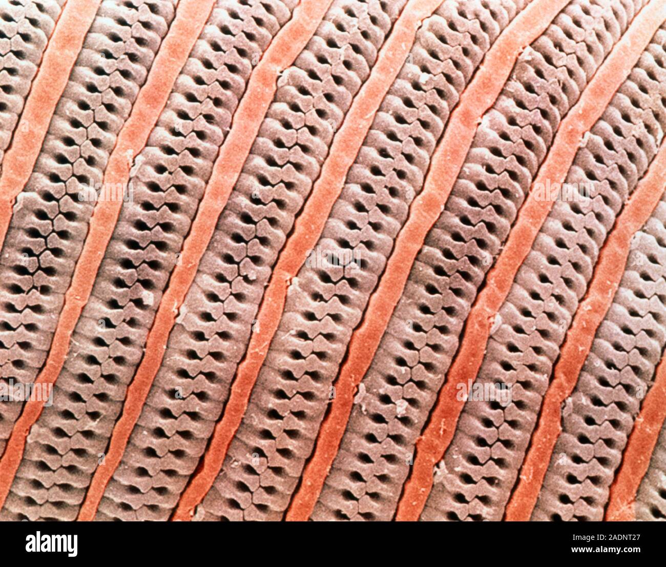 Proboscis of flesh fly. Coloured scanning electron micrograph of the ...