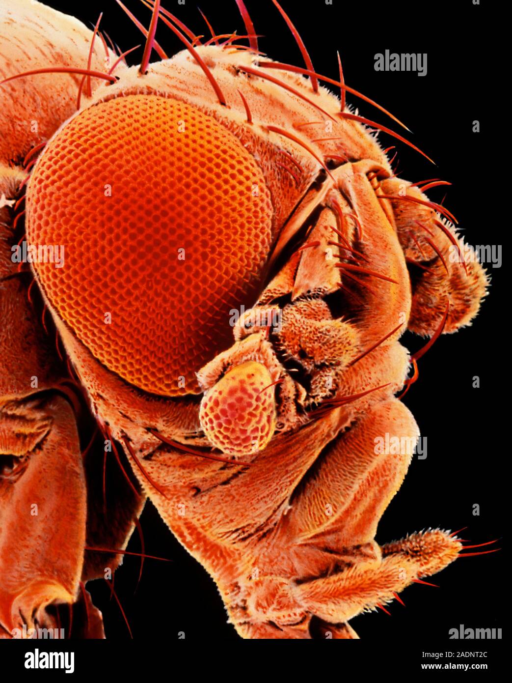 Ectopic eye in mutant fruit fly. Coloured scanning electron micrograph ...