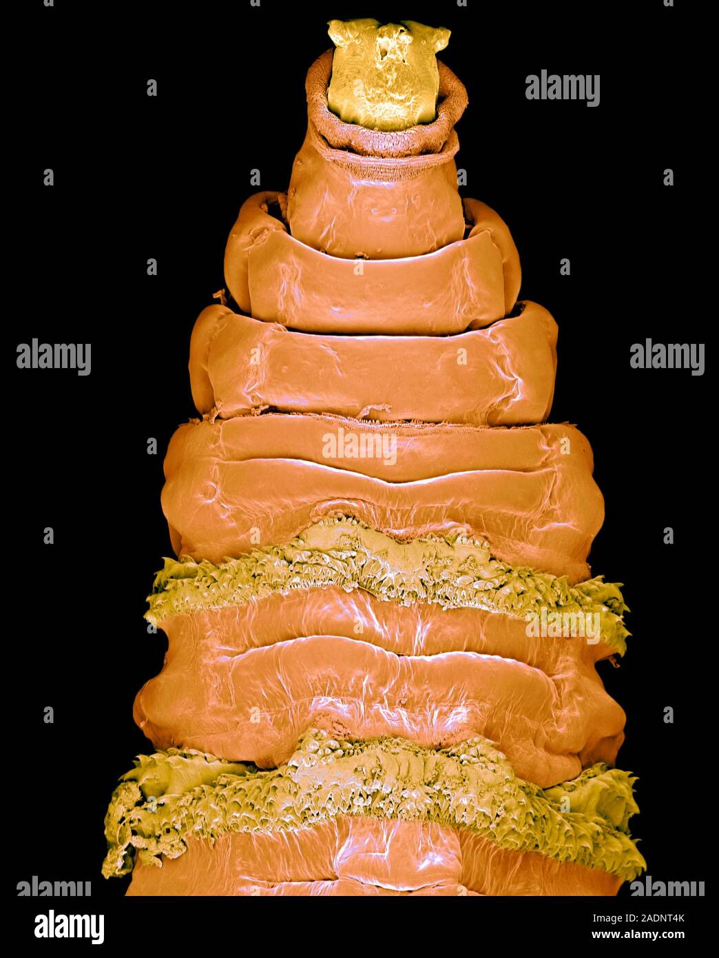 Maggot. Coloured scanning electron micrograph (SEM) of a surgical ...
