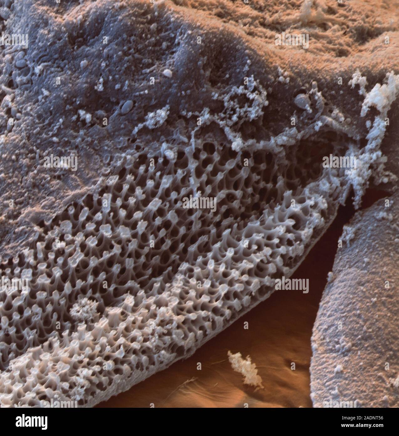 Fly egg. Coloured scanning electron micrograph (SEM) of the surface of ...
