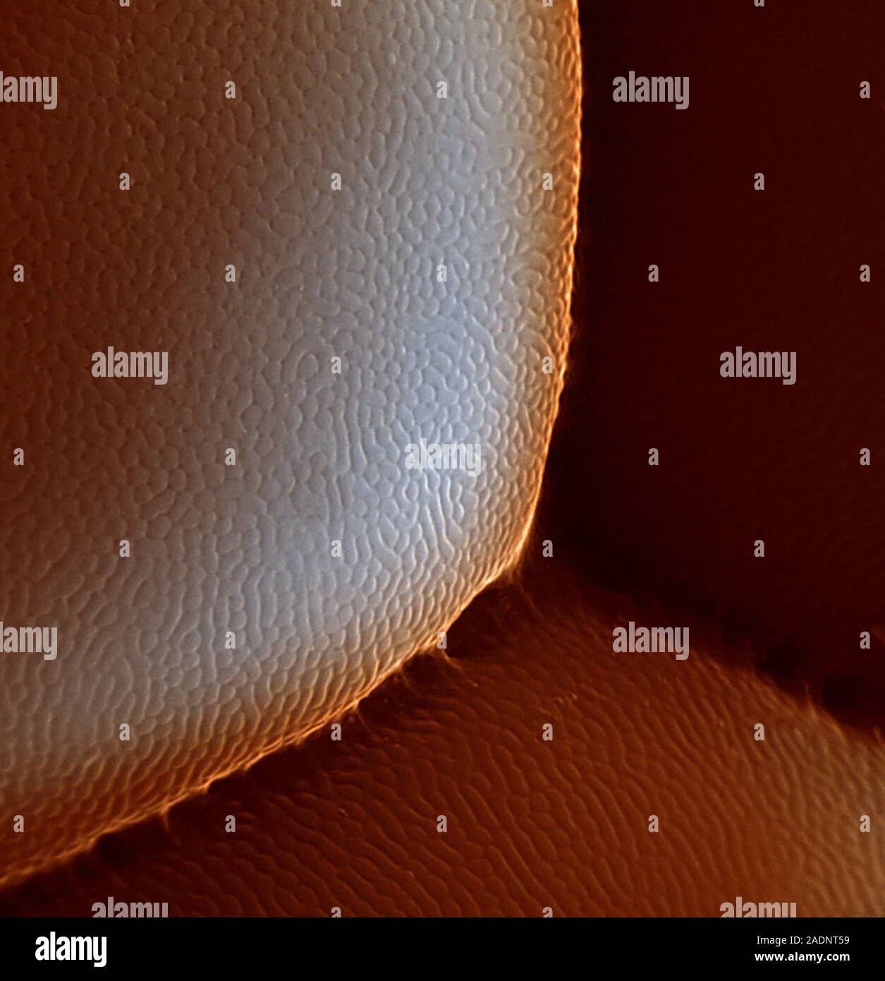 Housefly eye. Image 3 of 6. Coloured scanning electron micrograph (SEM ...