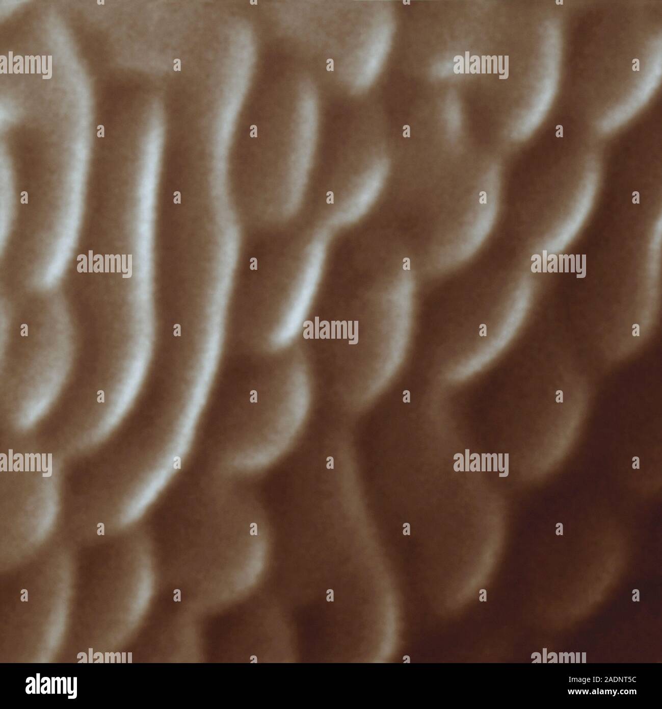 Housefly eye. Image 5 of 6. Coloured scanning electron micrograph (SEM ...