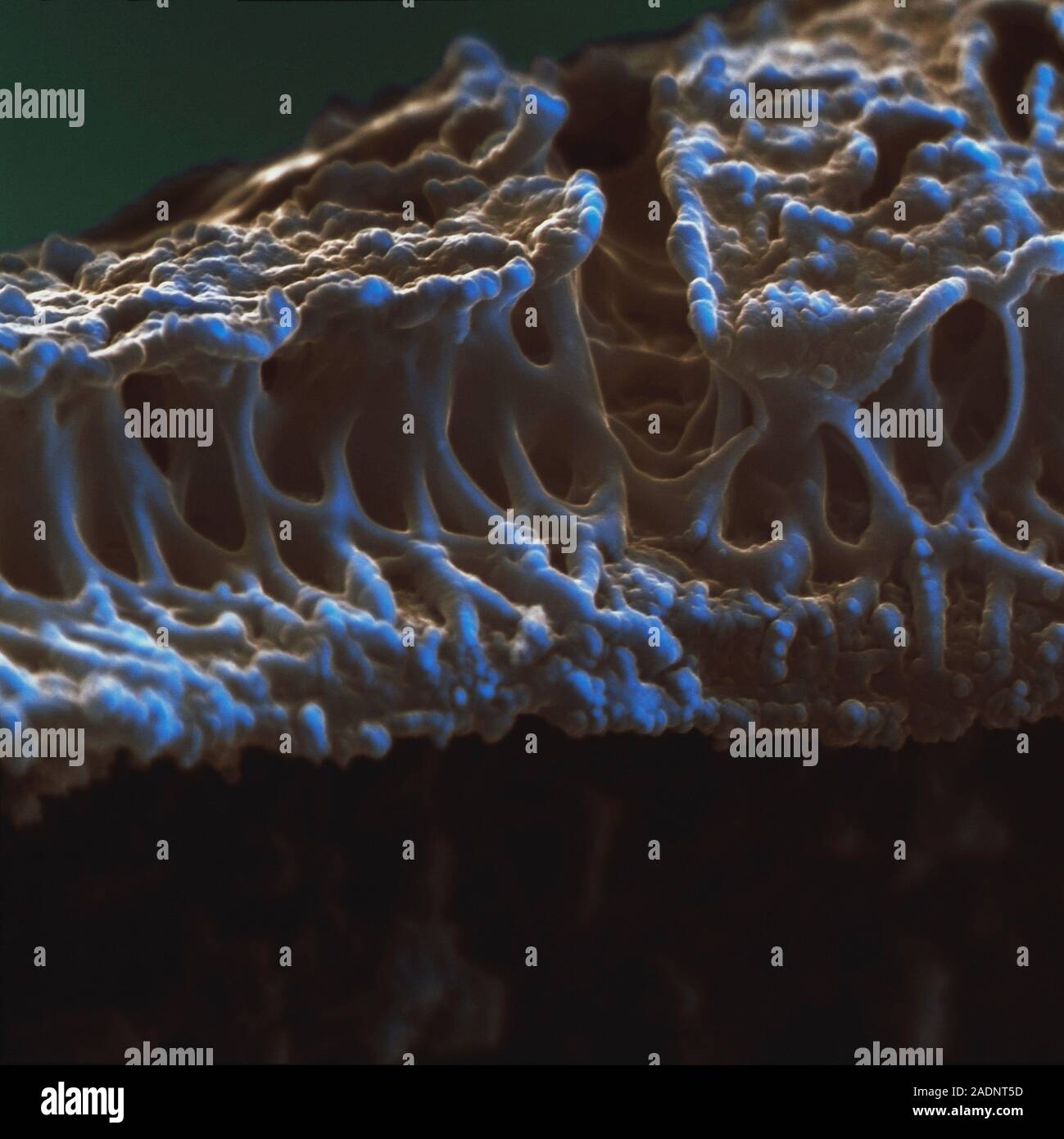 Fly egg. Coloured scanning electron micrograph (SEM) of the surface of ...