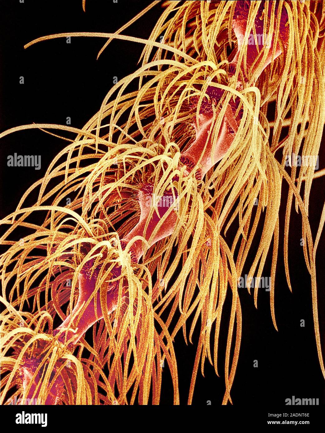 Moth fly antenna. Coloured scanning electron micrograph (SEM) of the ...