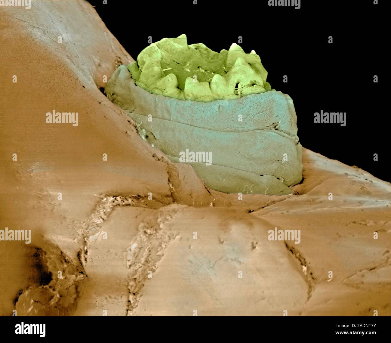 Blowfly maggot feeding. Coloured scanning electron micrograph (SEM) of ...