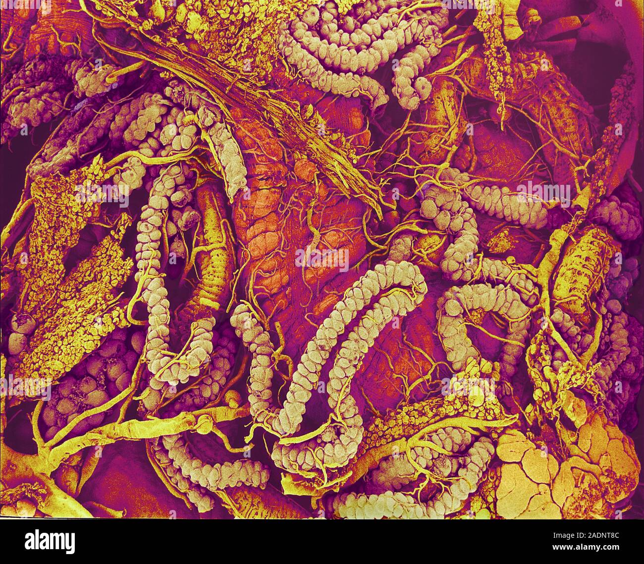 Hover fly gut. Coloured scanning electron micrograph (SEM) of the gut ...