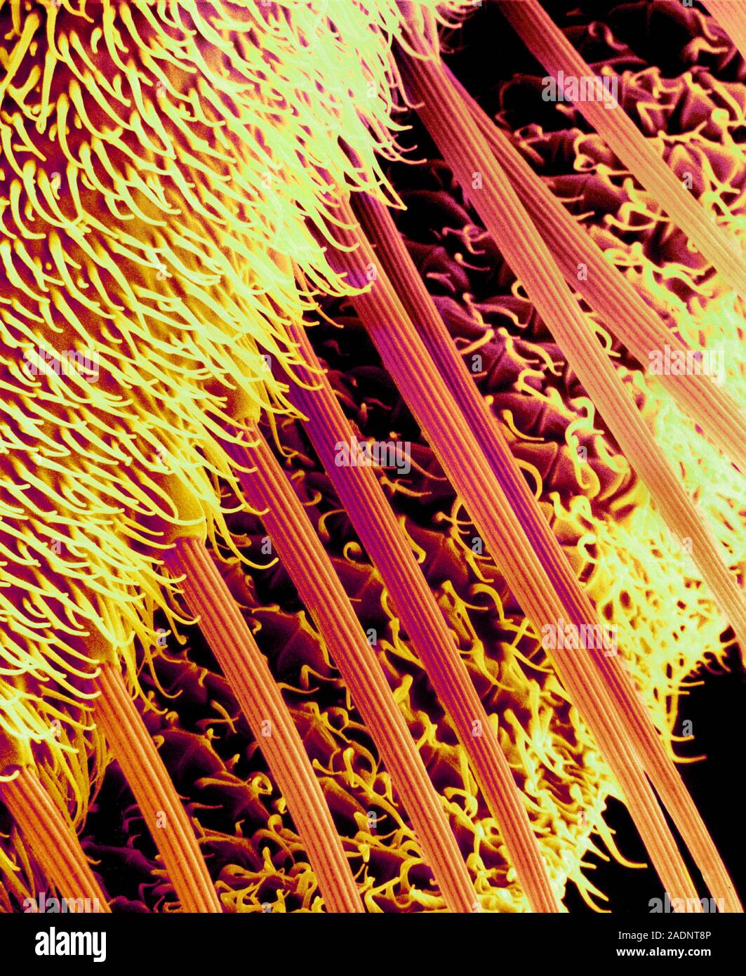 Balance organ of a fly. Coloured scanning electron micrograph (SEM) of ...