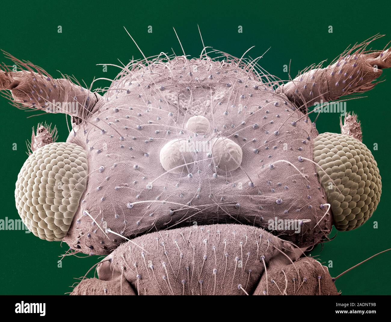 Fly. Coloured scanning electron micrograph of the top of the head of a ...