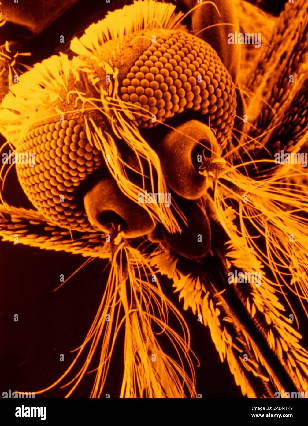 False-colour scanning electron micrograph (SEM) of the head of the male ...